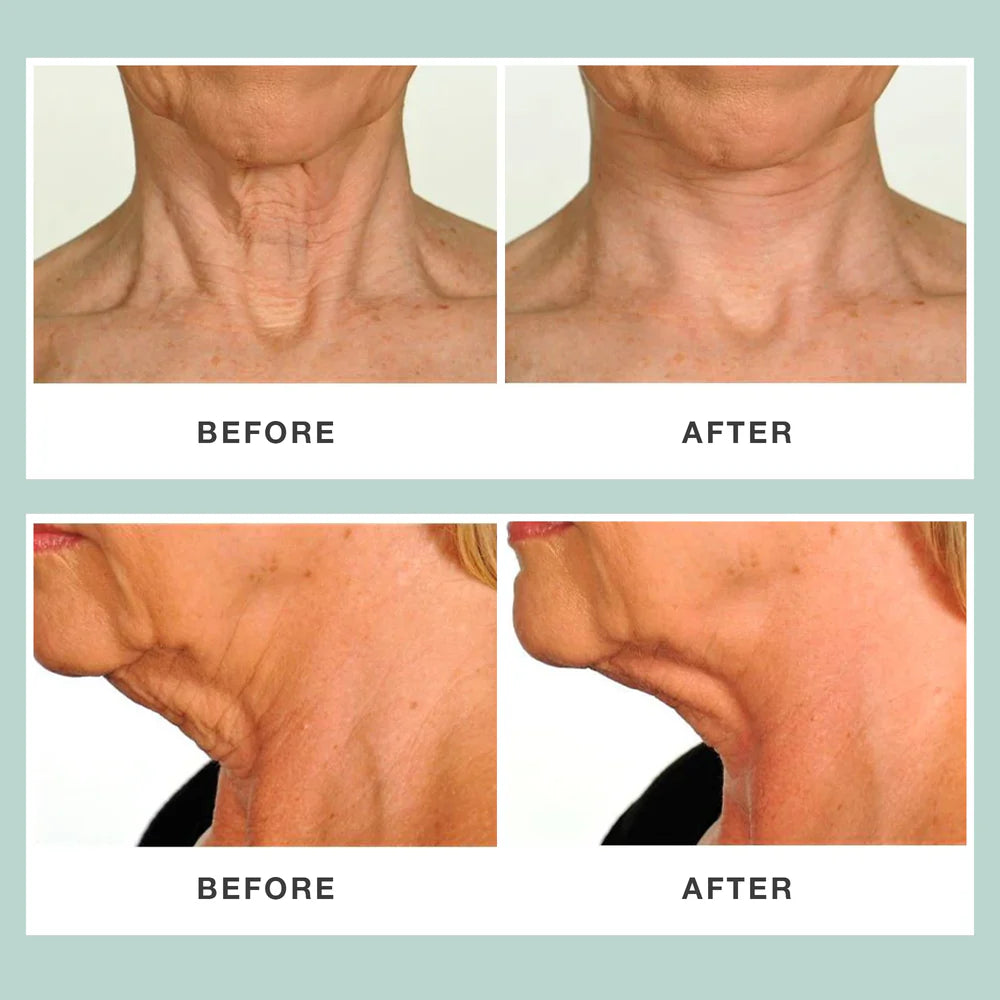 Contours Rx Neck Rescue 30 Strips – My Salon Time